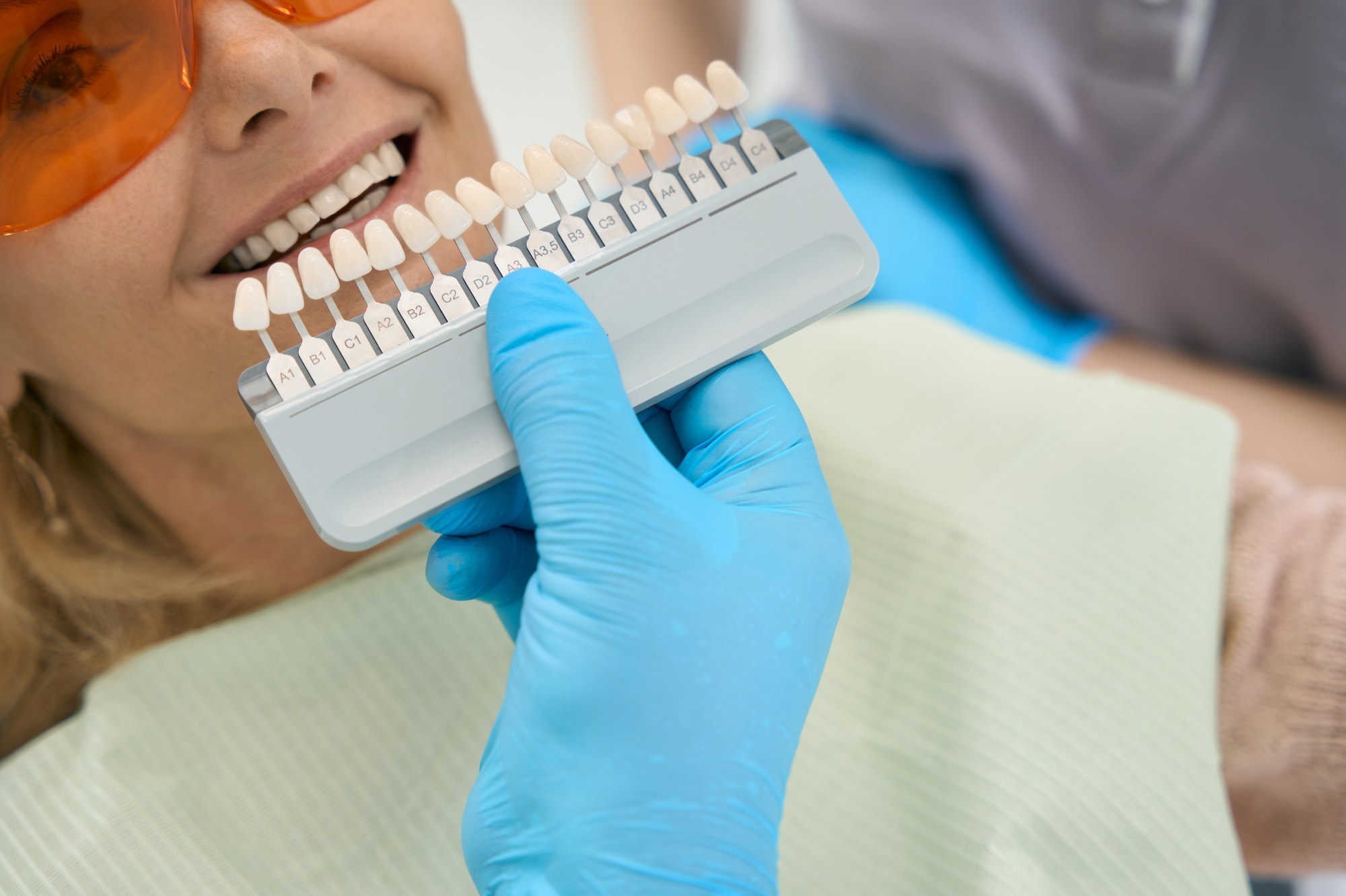 Teeth whitening in Hull - Spring Dental Practice | Hull, East Yorkshire.