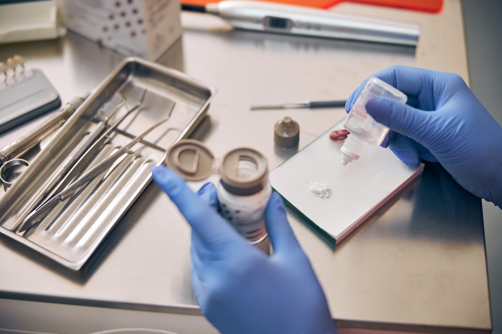 Dental Filling in Hull - Spring Dental Practice | Hull, East Yorkshire.